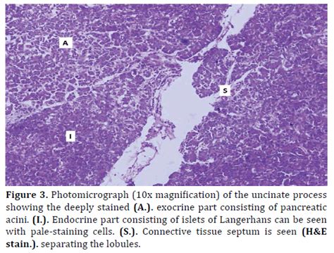 Histomorphological Study Of Unusual And Extensive Uncinate Proces