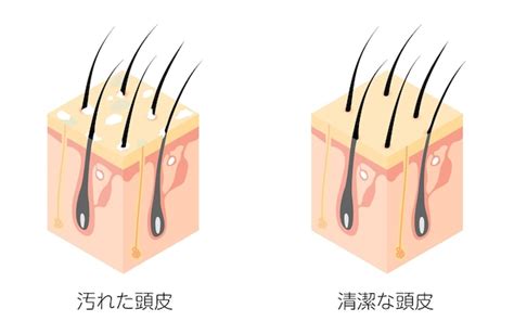 Premium Vector Diagrammatic Illustration Of A Cross Section Of A Dirty Scalp And A Clean Scalp