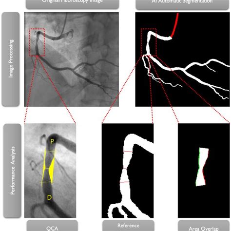 Overview Of The Segmentation And Analysis Process Top Left Baseline