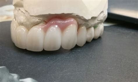 Pin On Dental Work Dish Soap Dishes Dental