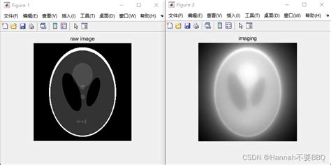 直接反投影重建算法（matlab）matlab Iradon具体算法 Csdn博客