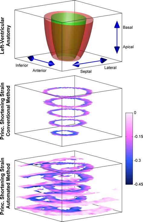 Automated Cardiac Motion Estimation From 3d Cine Dense Mri Journal Of Cardiovascular Magnetic