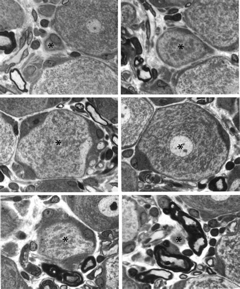 Light Micrographs Of Serial Semithin Sections Showing A Nerve Cell Body