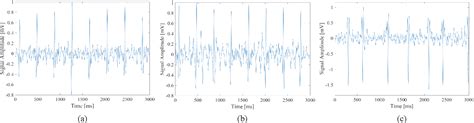 Figure 1 From Fetal Arrhythmia Detection Based On Labeling Considering Heartbeat Interval