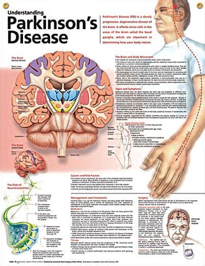 Parkinson S And Skin Conditions Mapasgmaes