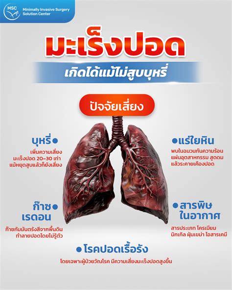 Msc 🚭 ไม่สูบบุหรี่ ก็เสี่ยง “มะเร็งปอด” ได้ หลายคนไม่รู้ว่า สารพิษในอากาศ ก๊าซเรดอน หรือ