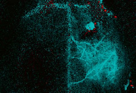 Cerebral Blood Flow Monitoring Perimed