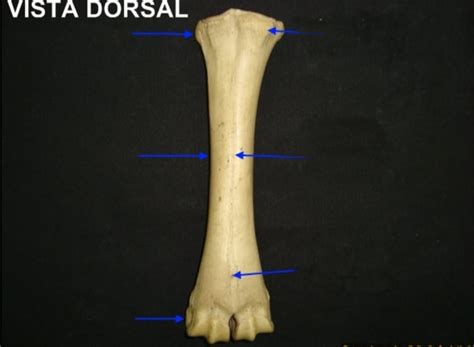 Juegos De Ciencias Juego De Metacarpo Visão Dorsal Cerebriti