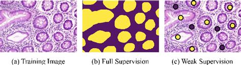 Figure 1 From Weakly Supervised Histopathology Image Segmentation With Sparse Point Annotations