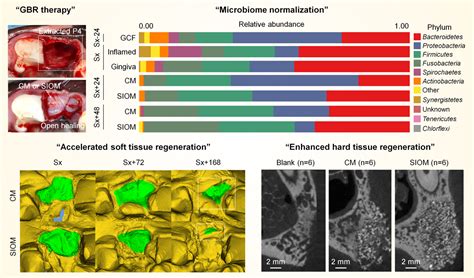 연세대 홍진기 교수팀 구강 미생물과 건강하게 소통하여 잇몸과 뼈를 동시에 재생시키는 치과 임플란트용 멤브레인 개발 Professor Jinkee Hongs Team