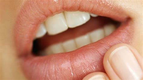 Oral Sex Is The Leading Risk Factor For Deadly Throat Cancer 8 Signs