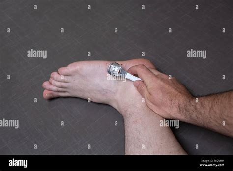 Man Removing Corn Callus From His Feet Using A Razor File Masculine