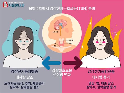 갑상선 서울본내과