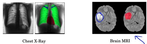 Semantic Segmentation With U Net Class Review Xiaohus Blogs