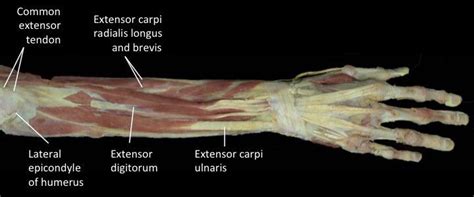 Common Extensor Tendon Alchetron The Free Social Encyclopedia