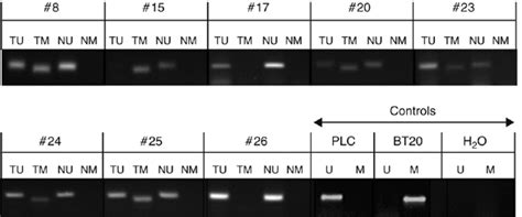 Sfrp1 Promoter Methylation In Rcc Msp Was Performed On Download
