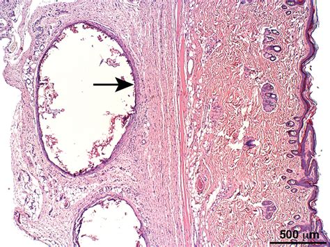 Preclinical Safety Evaluation In Rats Of A Polymeric Matrix Containing An Sirna Drug Used As A