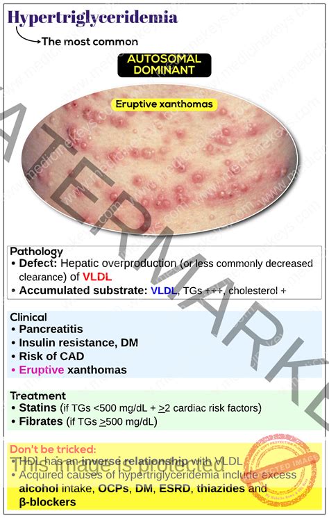 Hypertriglyceridemia Type Iv Medicine Keys For Mrcps