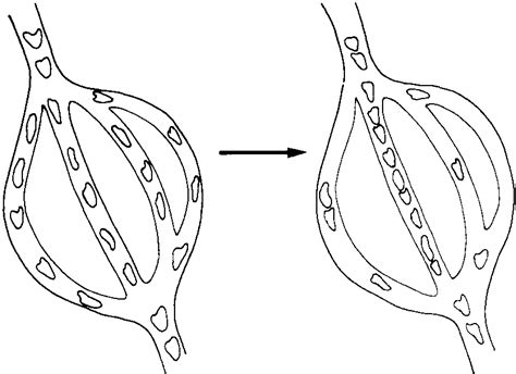 Schematic Representation Of The Nonuniform Radial Distribution Of Red