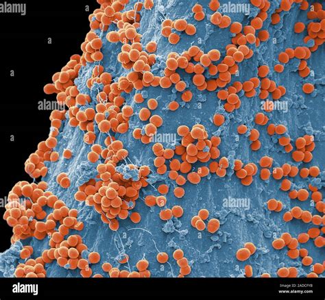 Staphylococcus Bacteria Coloured Scanning Electron Micrograph Sem Staphylococcus Is A Genus