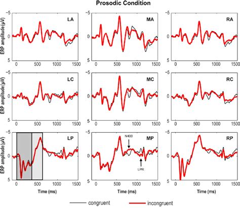 Erp Average Waveforms For Prosodic Condition Erp Average Waveforms Are