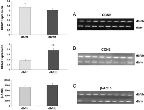 CCN Expression Is Increased At A Late Stage In A Model Of Type Two Download Scientific Diagram
