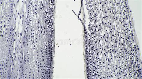 Root Tip Of Allium Cepa In Longitudinal Section Magnified By Microscope
