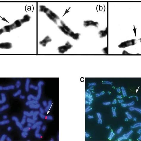 BS Cells Are Characterized By Increases In TAs Of Homologous Chromosome Download Scientific