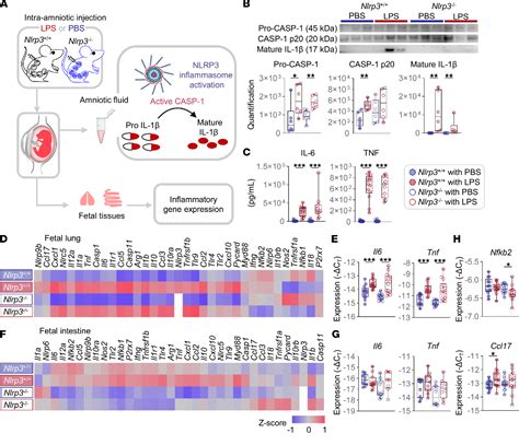 Figure 1 From Fetal And Maternal Nlrp3 Signaling Is Required For