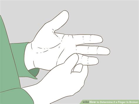 How To Determine If A Finger Is Broken With Pictures WikiHow