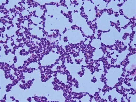 Staphylococcus Aureus Under Microscope Biology Notes Online