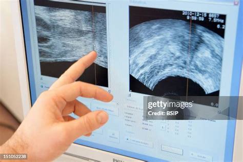 High Intensity Focused Ultrasound Photos And Premium High Res Pictures