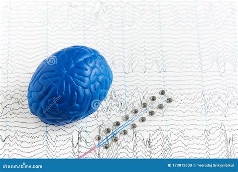 Subdural Grid Electrode For Brain Waves Recording On The Base Of Brain