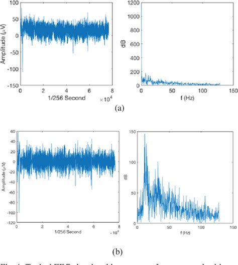 Figure 1 From Complexity Analysis Of Eeg Signal In Patients With