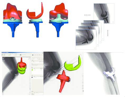 The Two‑dimensionalthree‑dimensional Registration Technique Uses Download Scientific Diagram