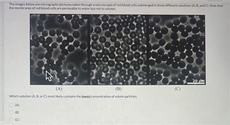 Solved The Images Below Are Micrographs Pictures Taken Chegg