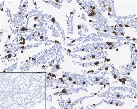 Cre Recombinase Recombinant Rabbit Monoclonal Antibody Psh01 93 Ha7