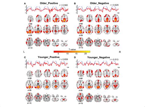 Spatial Activation Maps Of The Task Related Components And Associated