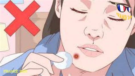 Whats The Difference Between A Zit And A Pimple Zit Vs Pimple Understanding Acne And Skin