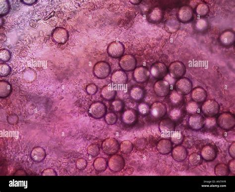 Nematocysts Under Microscope