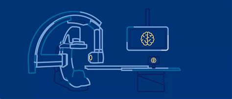 Direct To Angio Suite Philips