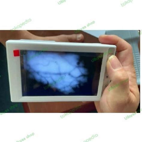 jual medical vein imaging device veinpuncture using vein viewer vein
