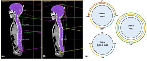 Isocentre Positions And Arc Directions With Overlapping Regions A