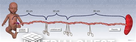 Umbilical Cord