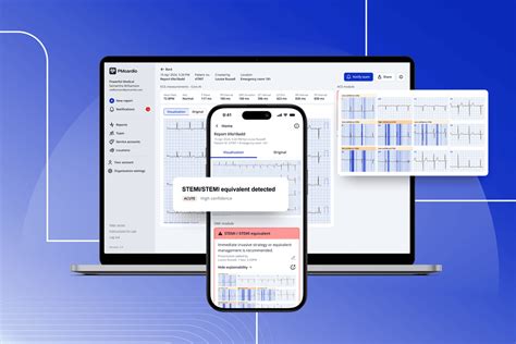 Hyperacute T Waves A Comprehensive Pattern Exploration