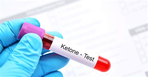 Continuous Ketone Monitoring For Type 1 Diabetes Diabetes Research And Wellness Foundation