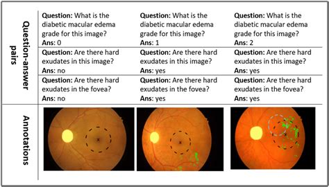 Examples Of Dme Dataset Images And Related Qa Pairs Where The Yellow