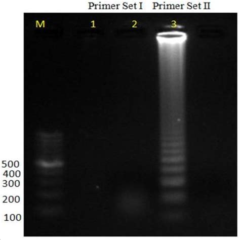 Visual Detection Of Lamp Products Using Intercalating Dye Sybr Green I Download Scientific