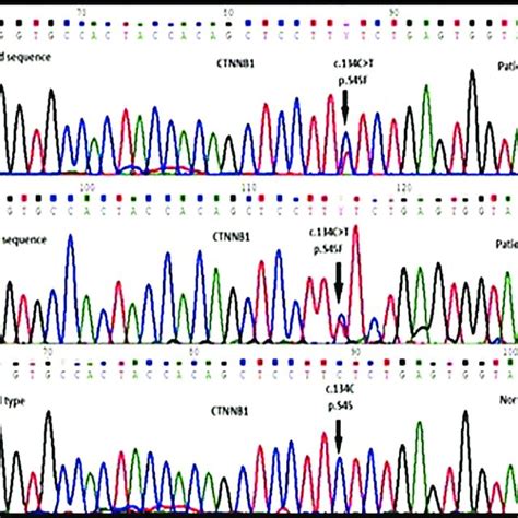 Bi Directional Sanger Sequencing Performed On Dna Extracted From The
