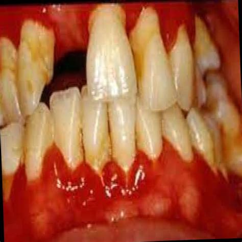 Augment Object Detection Dataset By Dental